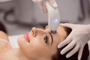 MNRF Treatment – Dr. Kritika Derma Clinic